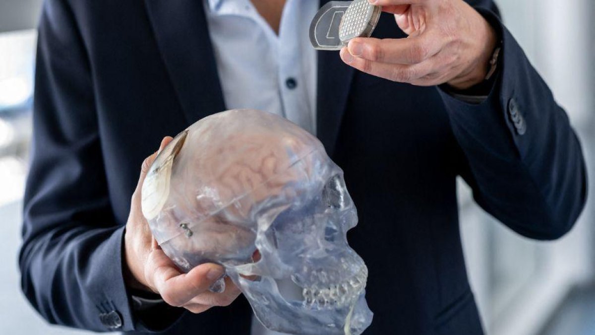 Paradromics, competencia de Neuralink, implantó con éxito un chip en un ...